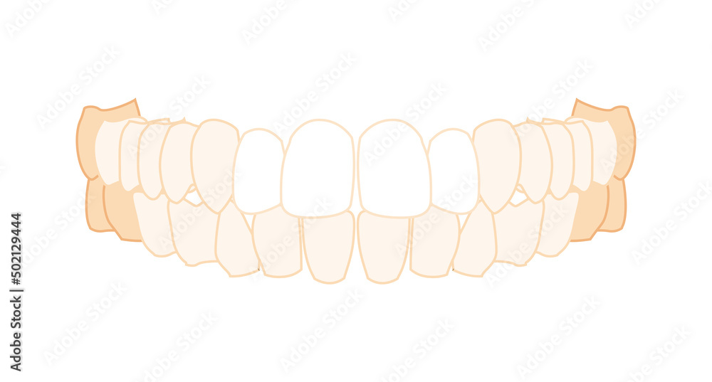 Teeth row Denture Set Closeup Human front anterior ventral view. Jaws ...