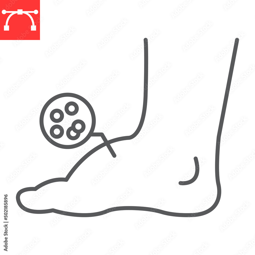 Leg edema line icon, diabetic and foot, leg swelling vector icon ...