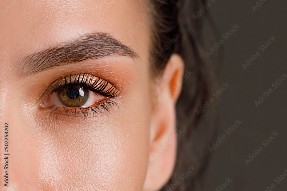 Female eye with red vessels and inflammation, dry eye syndrome, close ...