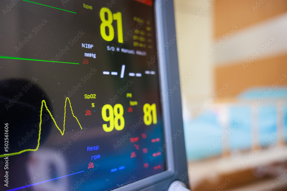 Electrocardiogram, EKG, heart rate monitor in hospital room for ...