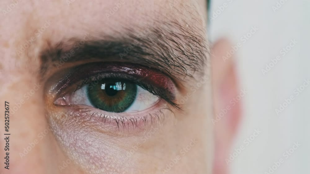 Bruise over the eye of a man, close-up. Young male face with a black ...