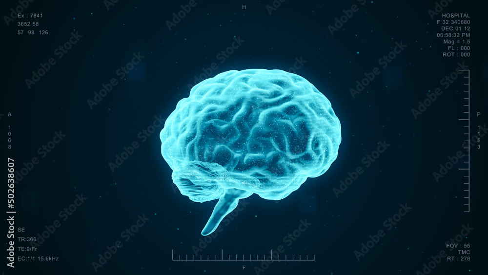 Human brain medical diagnosis interface, futuristic ct scan hologram ...