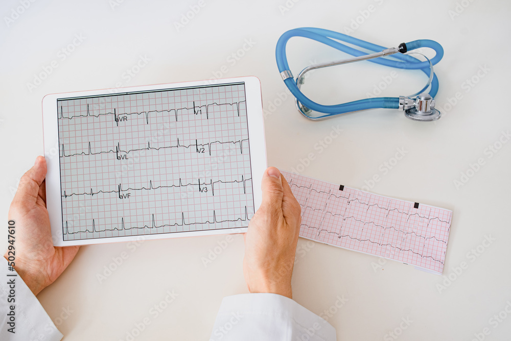 cardiologist holding the latest electrocardiogram of a patient with ...