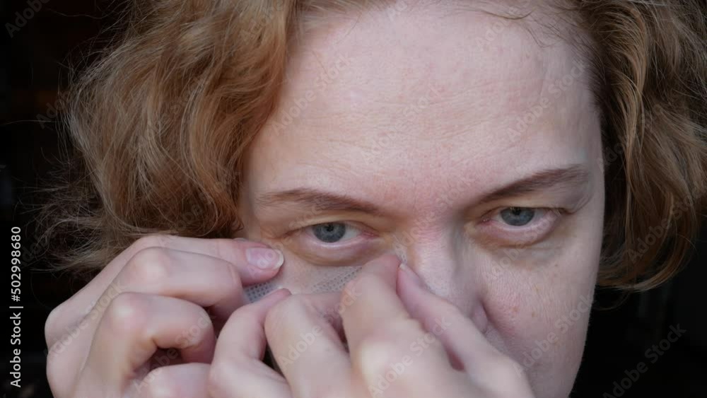 middle aged female's eye with drooping eyelid with patch for eyes ...