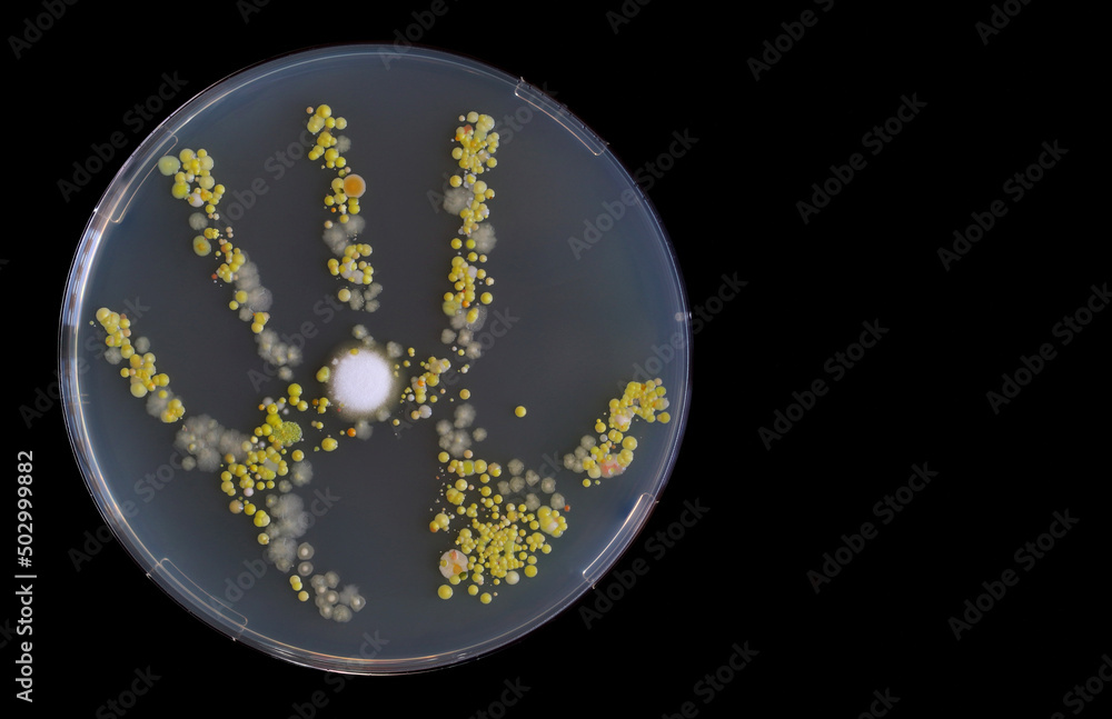 Germs on hands: colonies of bacteria and fungi in the hand of a young ...