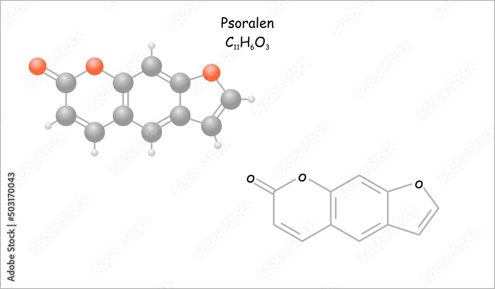 Stylized molecule model/structural formula and of psoralen. Phototoxic ...