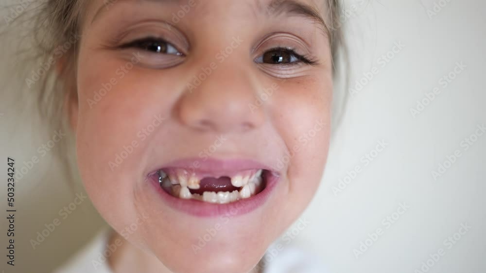baby no teeth. child smiling no milk a teeth fell out. medicine ...