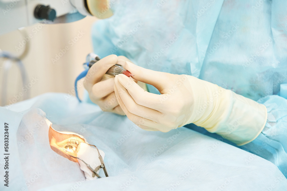 Ophthalmology laser microscope operation. Doctor surgery in clinic ...