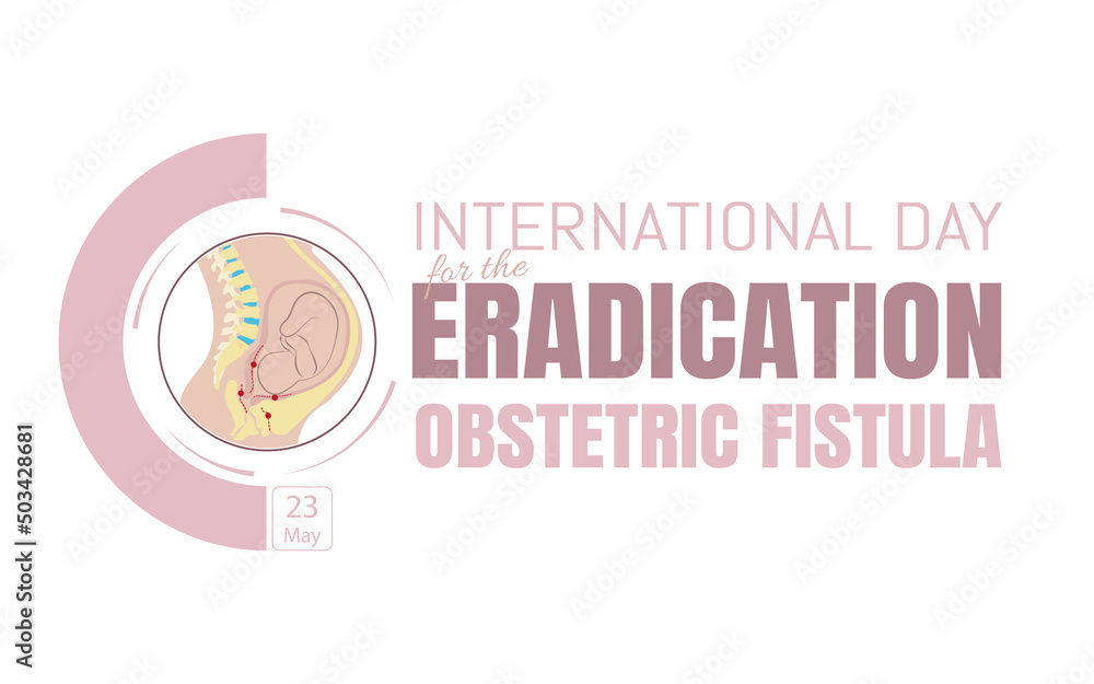 International Day for the eradication of obstetric fistula.diagram of ...