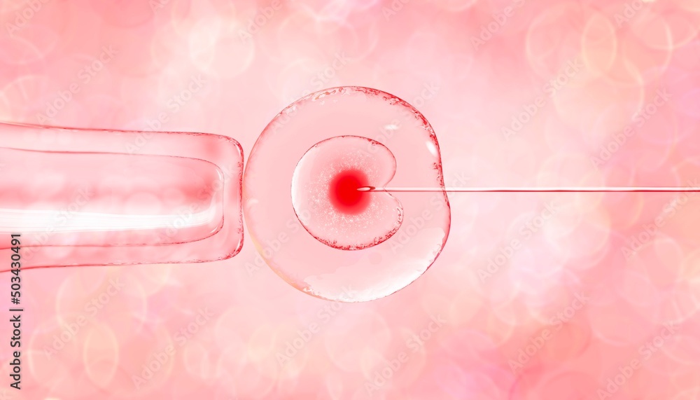 Photo & Art Print 3d illustration of in vitro fertilization under a ...