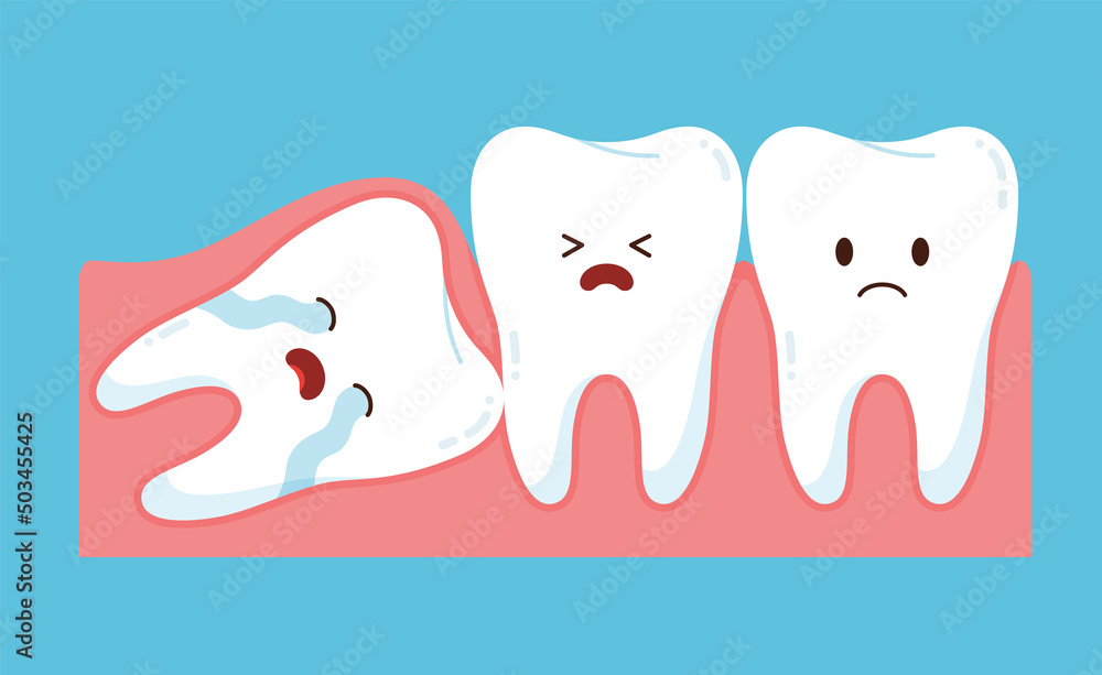 Wisdom tooth erupt through the gum, sad cartoon characters, flat vector ...