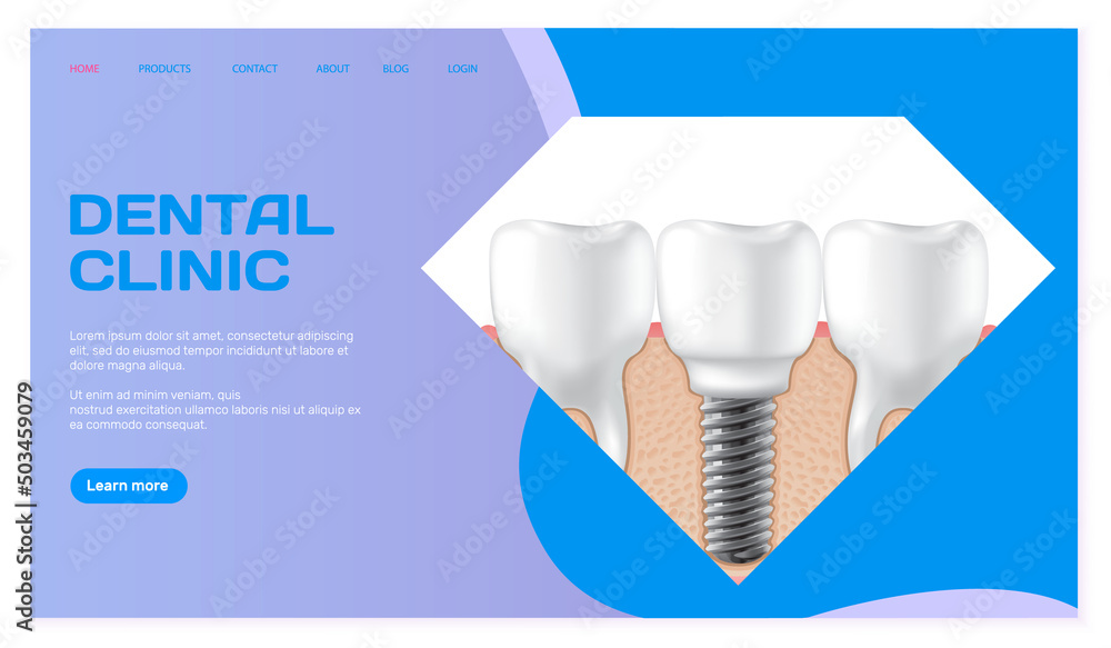 Dental clinic poster vector illustration. Advertising of hospital for ...