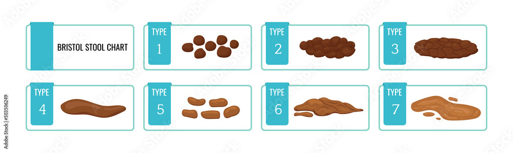 Bristol stool chart scale with faesces structure classification ...