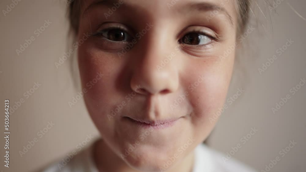 child girl playing funny a squinting eyes. strabismus squint happy ...