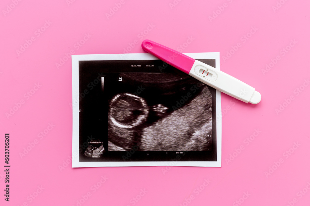 Positive pregnancy test with ultrasound picture of unborn baby Stock ...