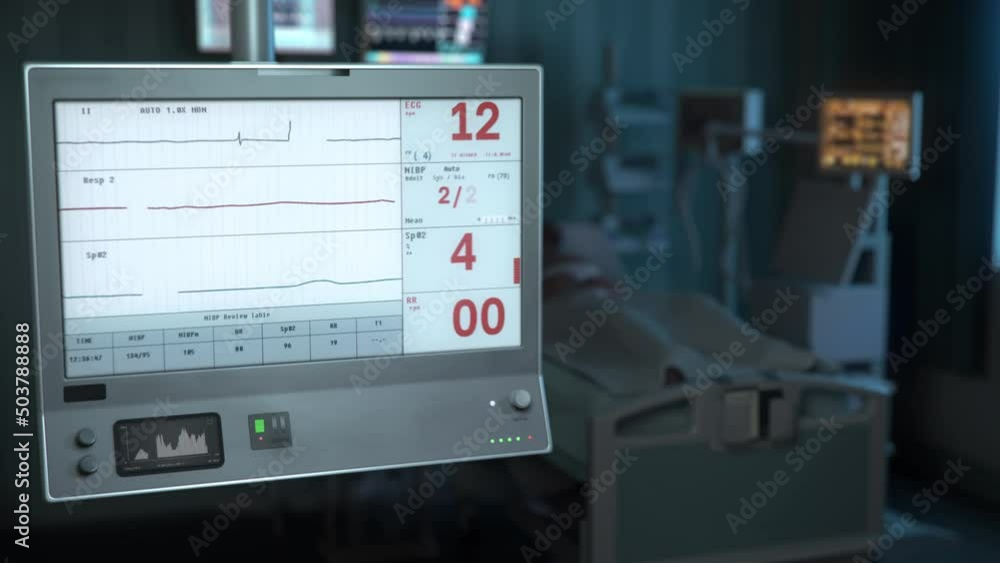 Cardiology Device Displays Graph Indicating Recovery From Critical ...
