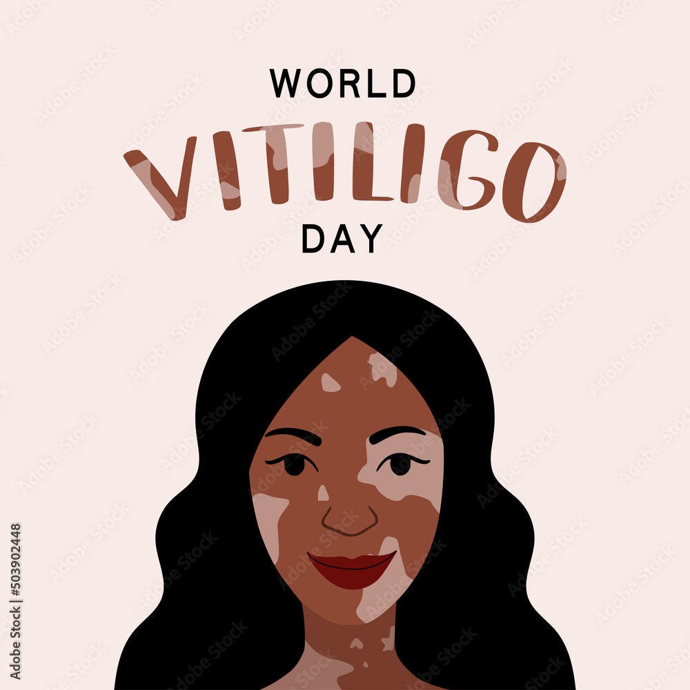 World Vitiligo Day square card, poster, banner. Young woman with ...