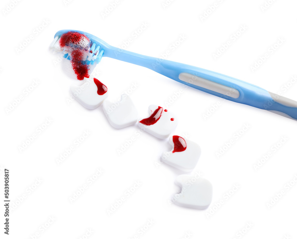 Decorative teeth and toothbrush with blood on white background. Gum ...