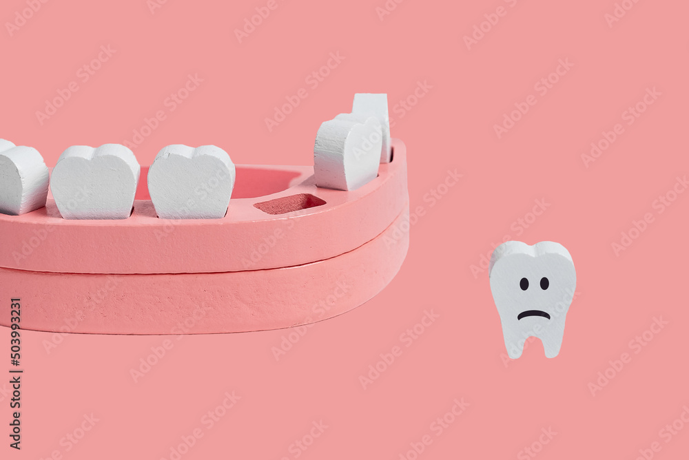 Teeth loss concept. Wooden jaw model with missing or extracted tooth ...