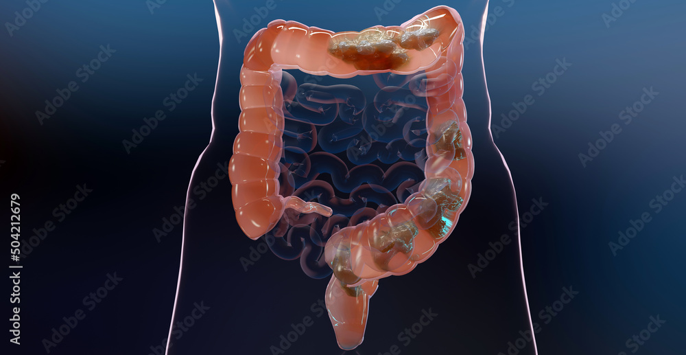 3d illustration of human digestive system anatomy, concept of the ...