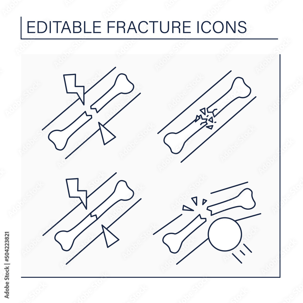 Fracture Line Icons Set Bone Break Oblique Comminuted Hairline And Impacted Fracture