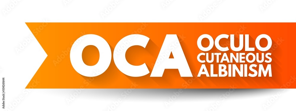 OCA Oculocutaneous Albinism - genetic disorder characterized by skin ...