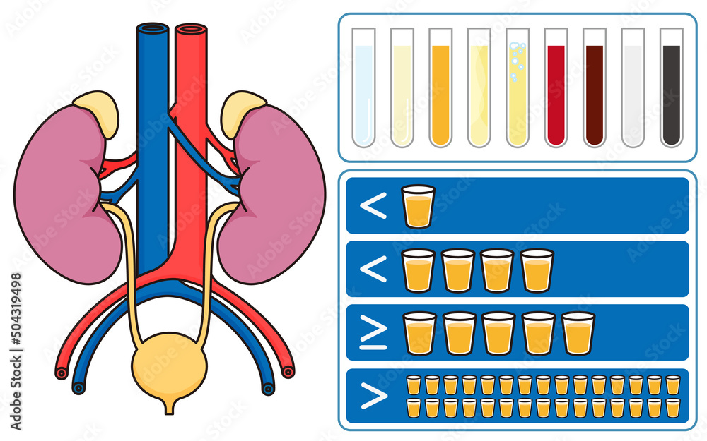 Vector illustration of kidney and bladder. Check urine color swatches ...