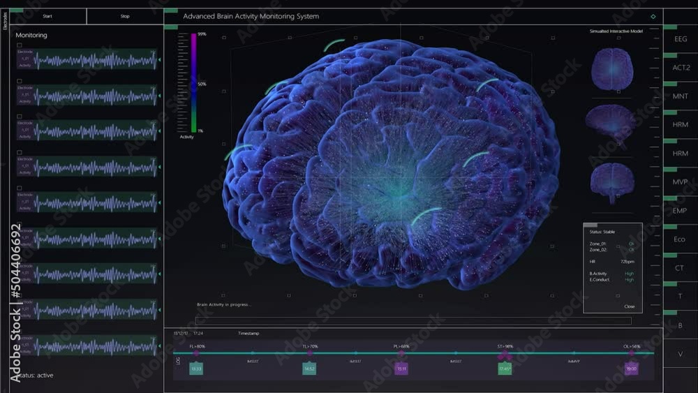 Brain Activity Monitoring System Mock-up with Multiple Windows and Data ...