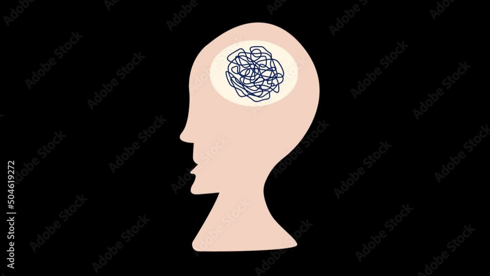 Vidéo Stock Head of confused person on transparent background 2D ...