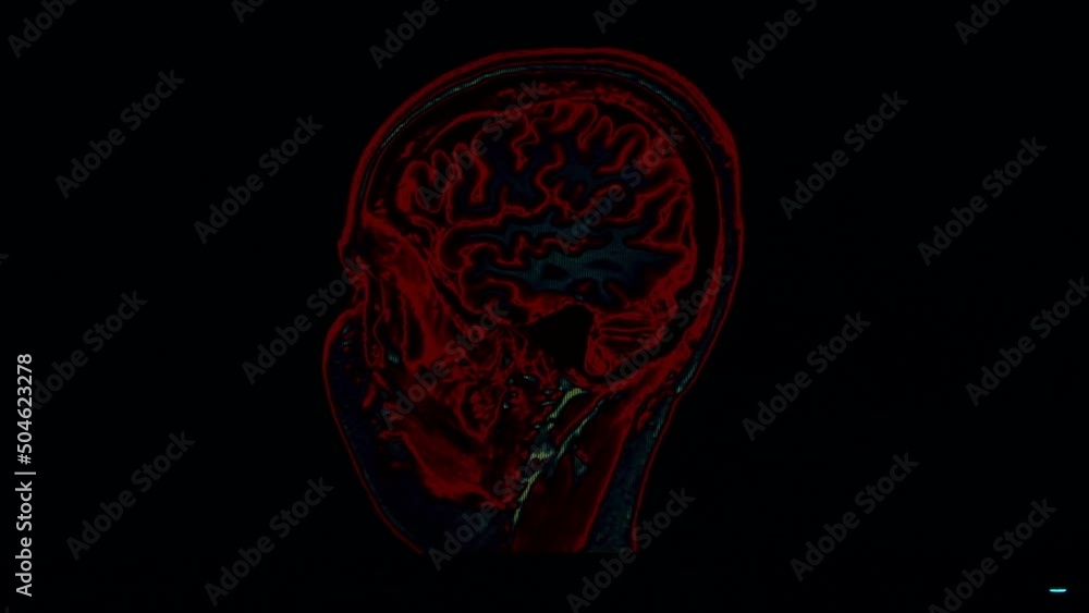 Brain mr scan colour. Brain magnetic resonance scan, imaging red and ...
