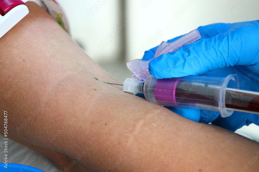 A female patient having blood drawn for testing Stock Photo | Adobe Stock