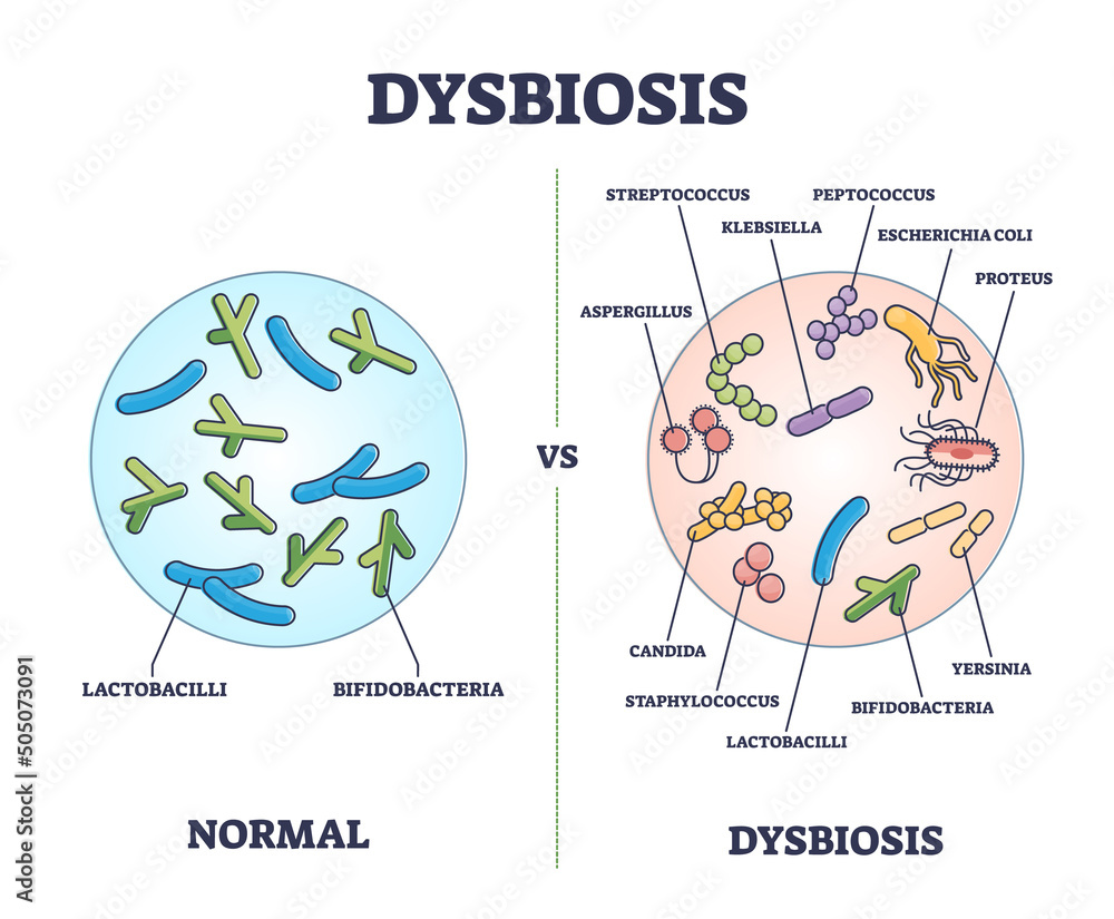 Dysbiosis versus normal gut or tract microflora with bacteria outline ...
