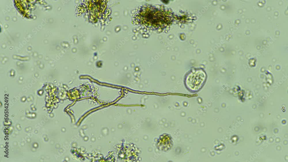 nematode in compost, in soil under the microscope vídeo de Stock ...