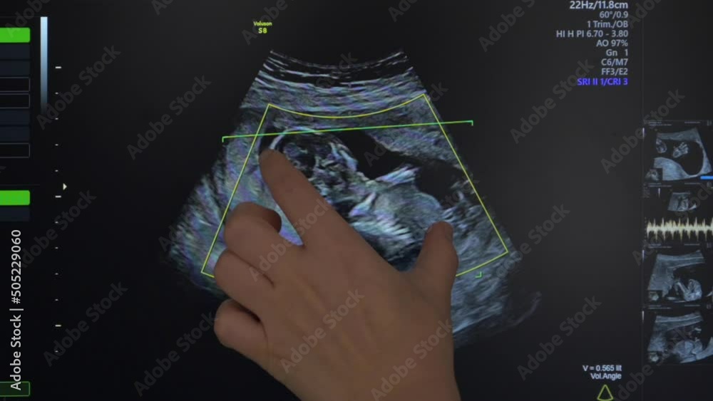 Vídeo do Stock: Ultrasonography of pregnant woman. Baby in mothers womb ...