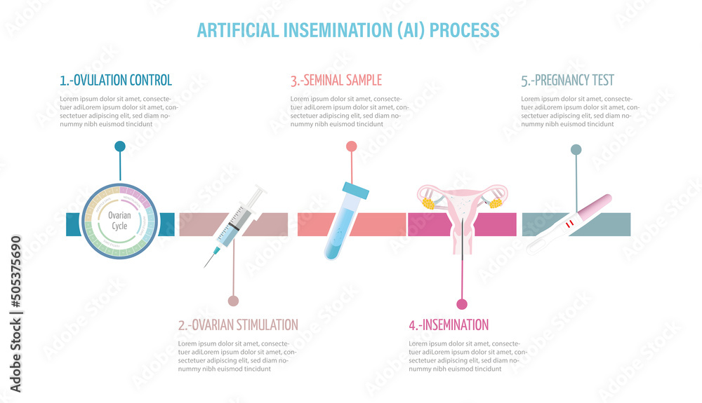 Infographic of the Artificial Insemination Procedure Stock Vector ...