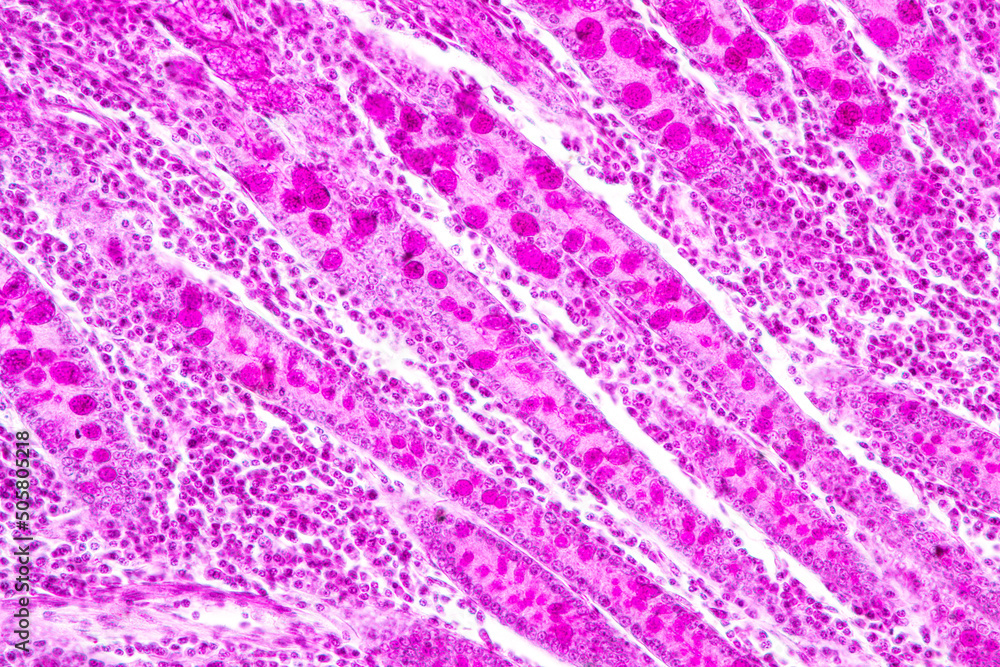 Foto de Tissue of Small intestine (Duodenum) and Vermiform appendix ...
