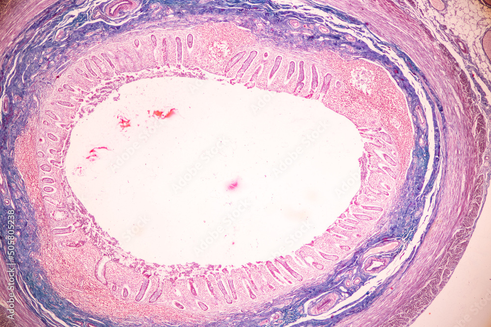 Tissue of Small intestine (Duodenum) and Vermiform appendix Human under ...