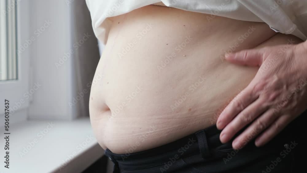 Overweight aged woman checks fat on belly. Woman compresses skin on ...
