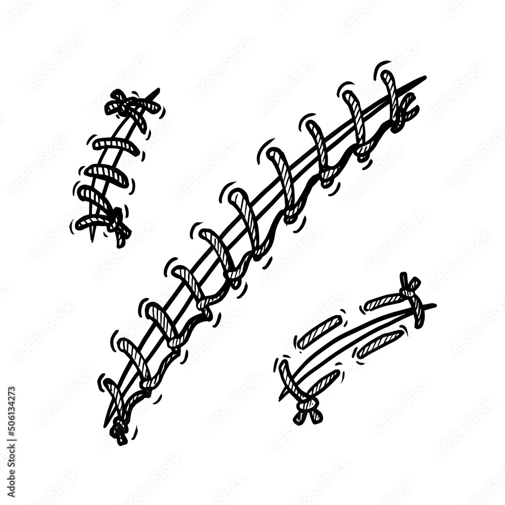 Set of medical stitches vector illustration isolated on white ...