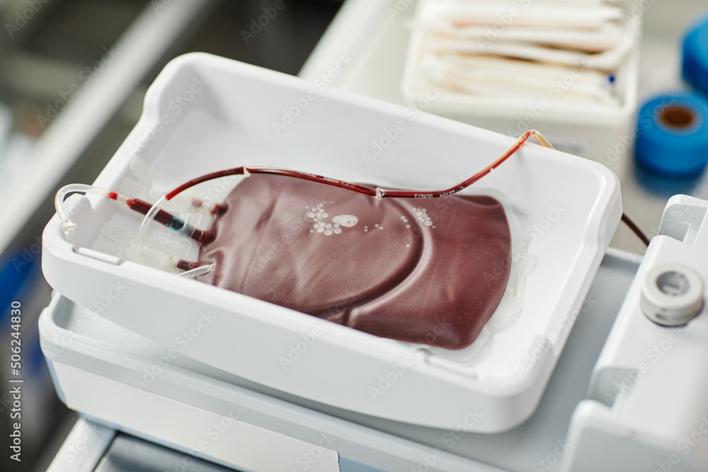 Top view closeup of filled blood bag in tray at blood donation center ...