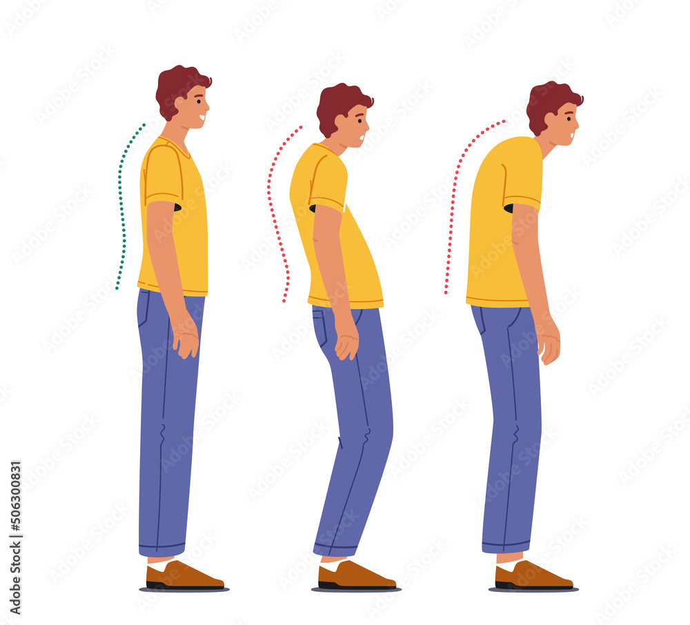 Scoliosis and Spine Backbone Curvature Concept. Man with Correct and ...