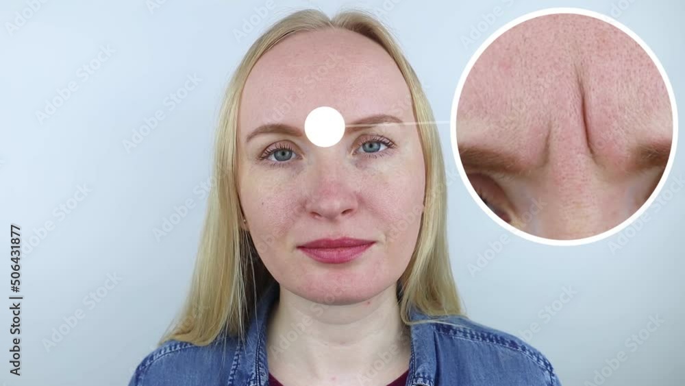 Mimic wrinkles. Concept. Lines remaining on problem areas of skin that has lost its elasticity ...