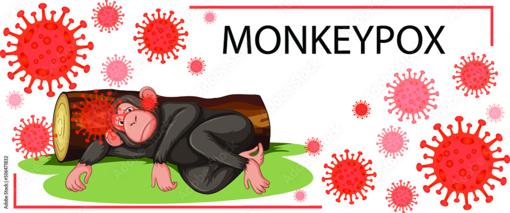 Monkeypox virus banner for awareness and alert against disease spread ...