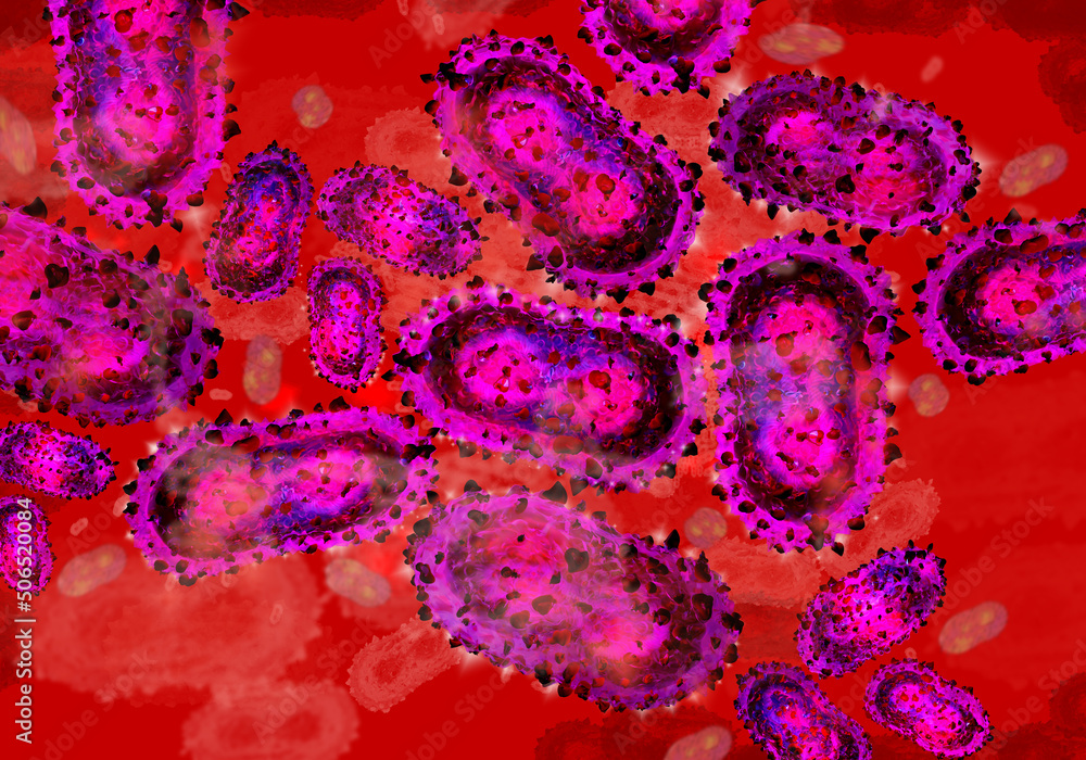 Monkeypox infestation. Smallpox virus blood. Monkeypox poxvirus ...