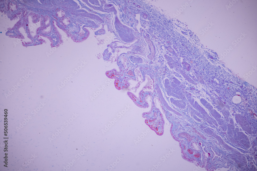 Columnar epithelium of human gall bladder under the microscope in Lab ...