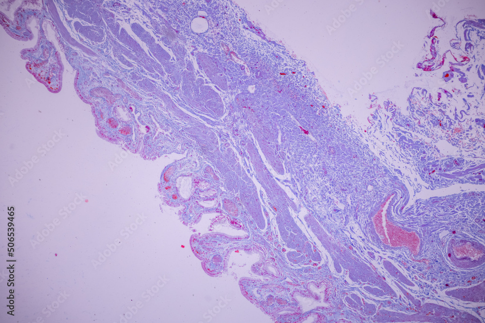 Columnar epithelium of human gall bladder under the microscope in Lab ...