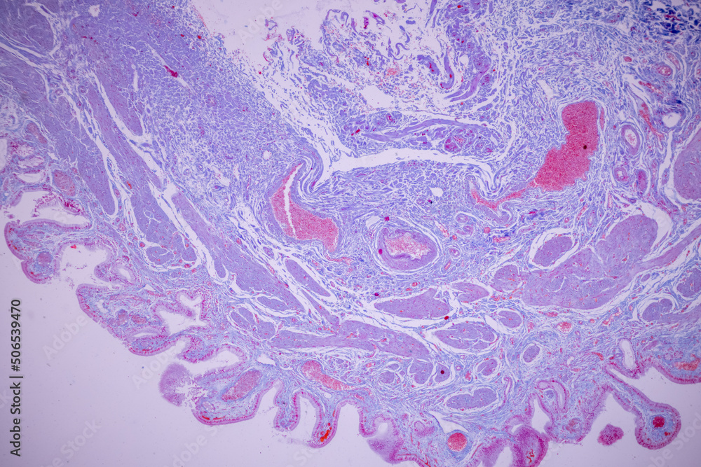Columnar epithelium of human gall bladder under the microscope in Lab ...