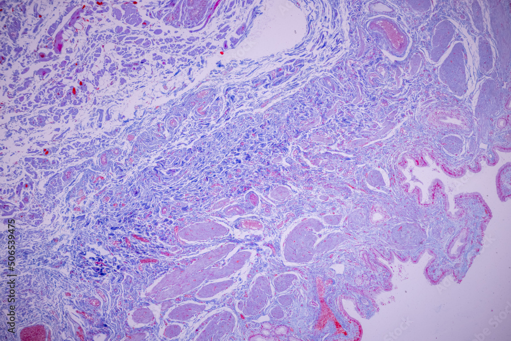 Poster Columnar epithelium of human gall bladder under the microscope ...
