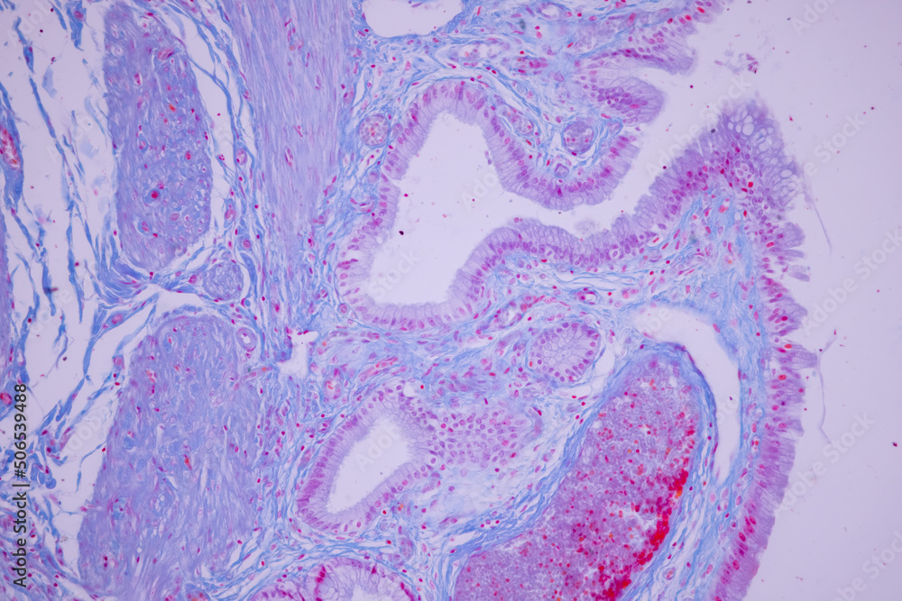 Columnar epithelium of human gall bladder under the microscope in Lab ...