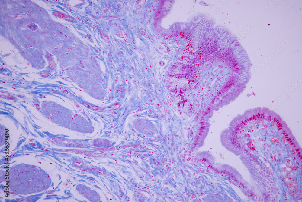 Columnar epithelium of human gall bladder under the microscope in Lab ...